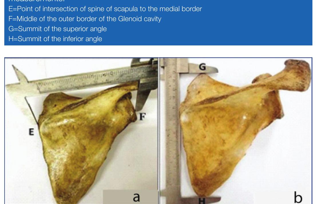 [table/fig-2]: measuring scapular breadth (sb) and scapular