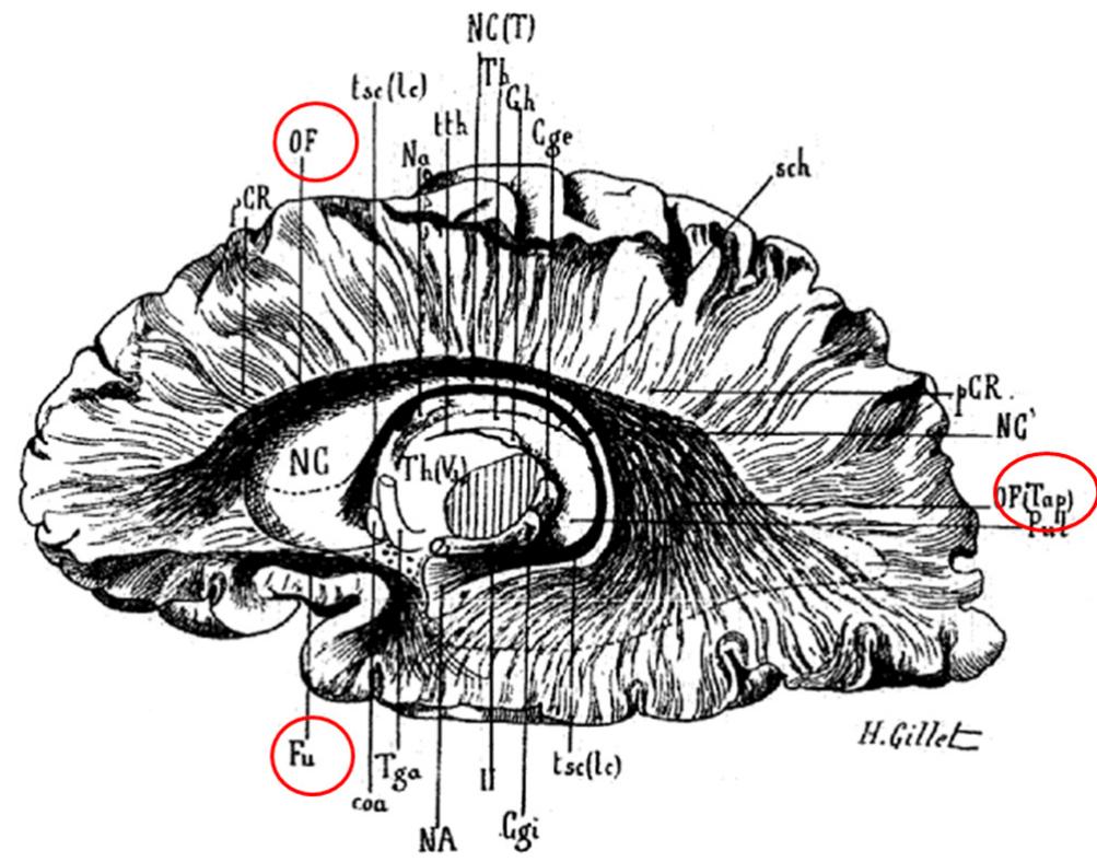 The corpus callosum and the cingulum were omitted on this