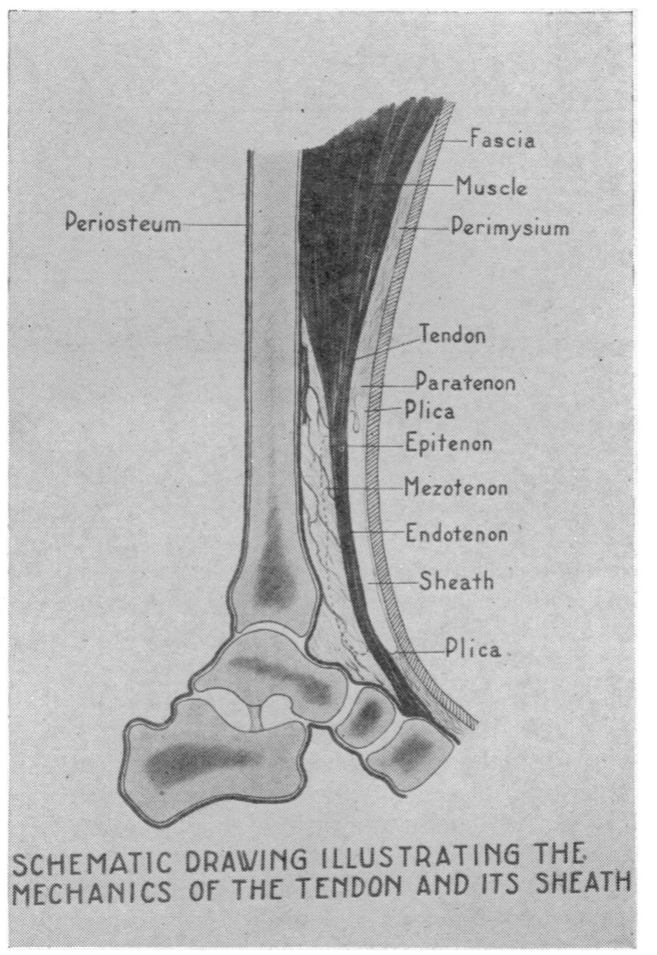 The evolution of modern tendon surgery