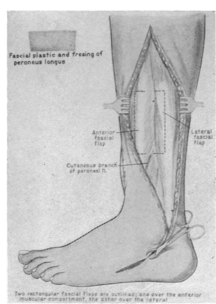Figure 9 - The evolution of modern tendon surgery