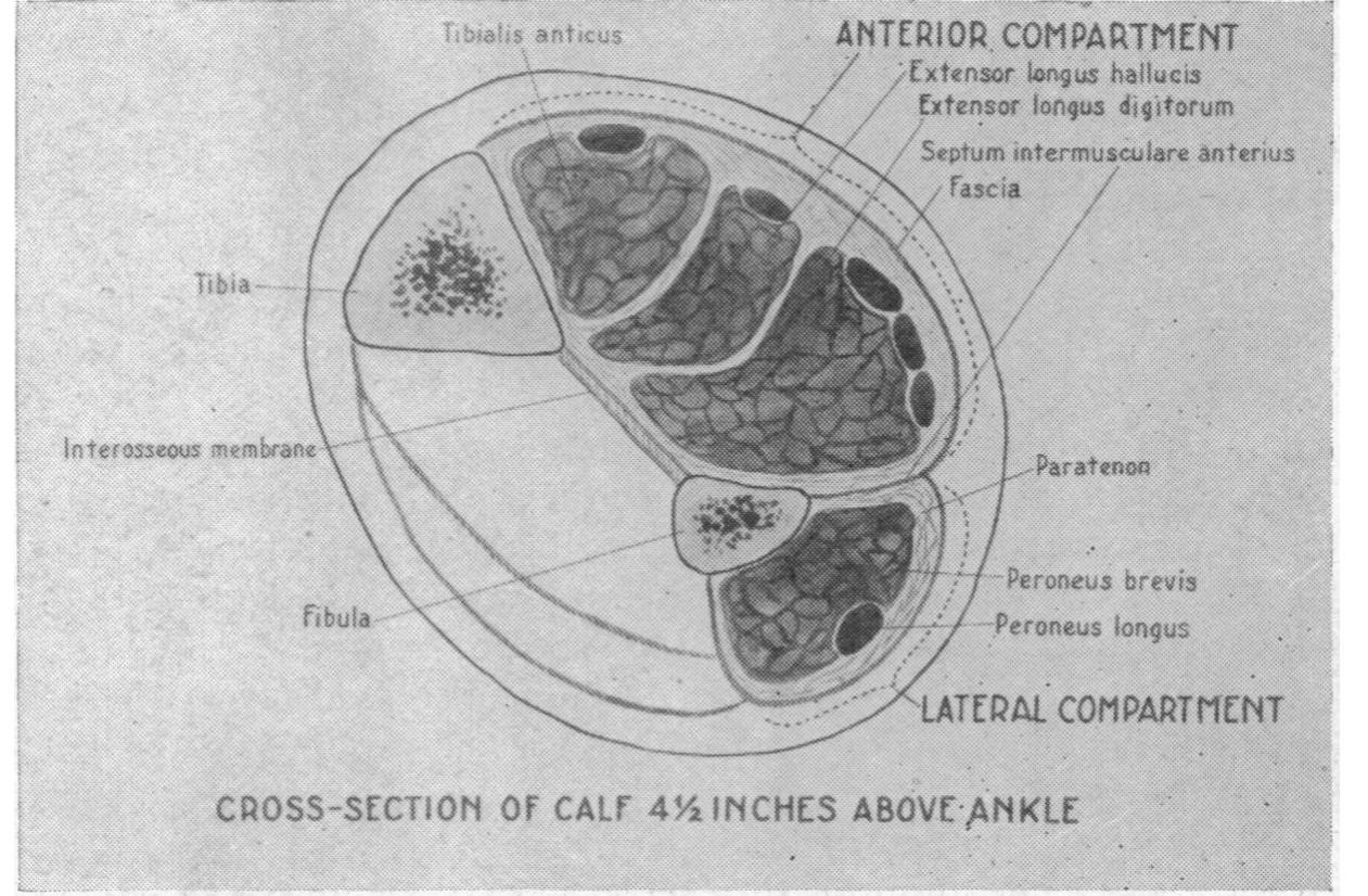 (i) cross-section of calf to illustrate the anterior and