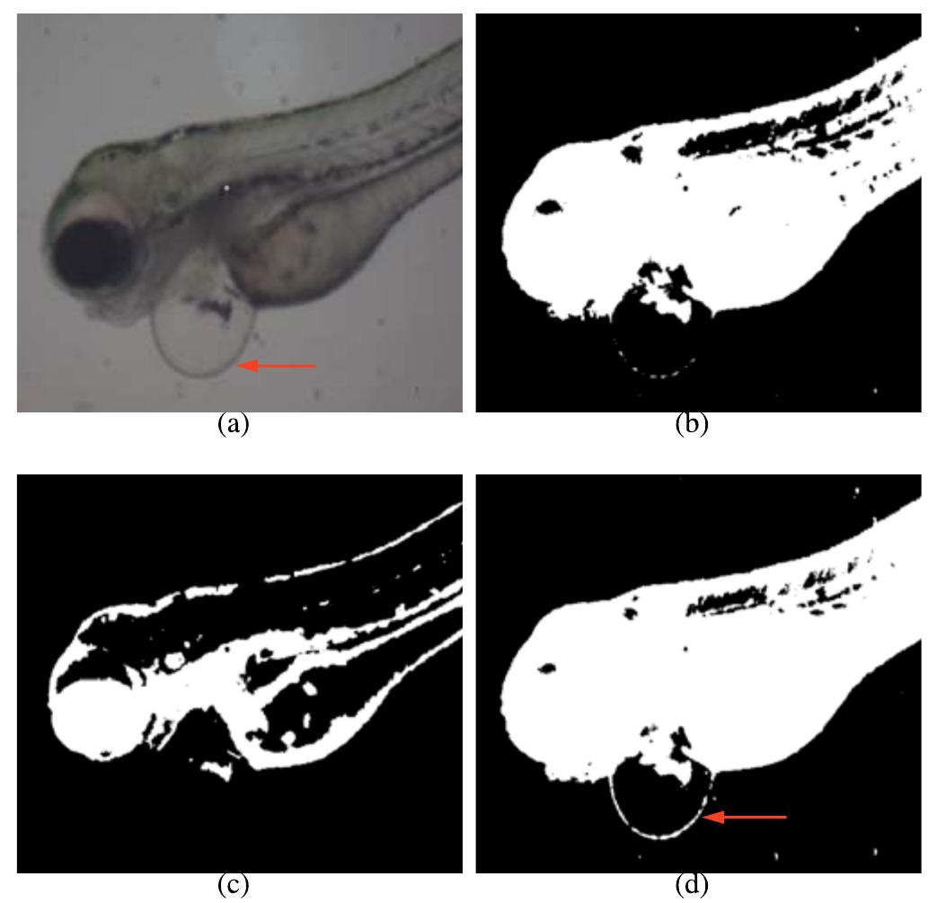 (a) a test image showing a zebrafish embryo acquired by a
