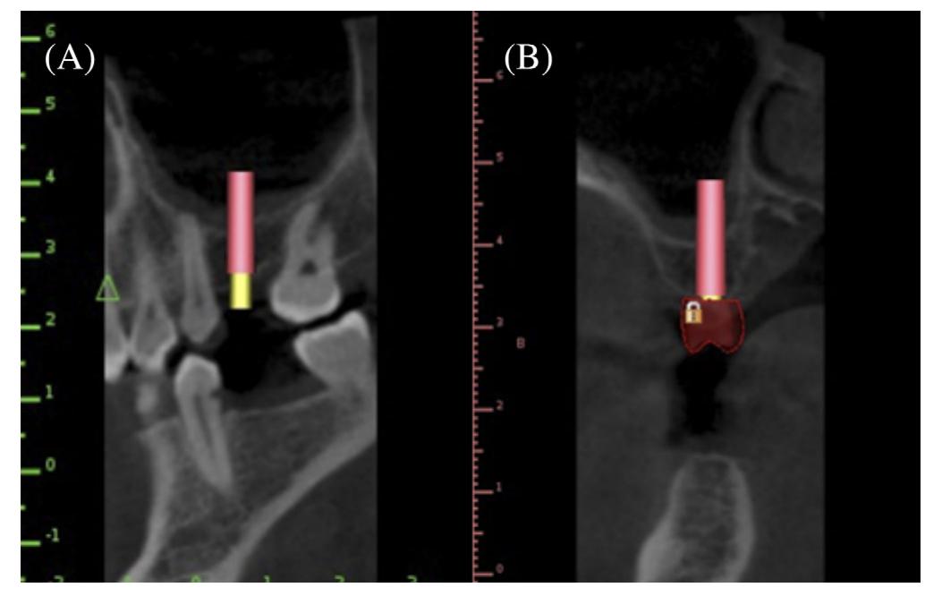 __ reformatted sagittal and cross section views from a