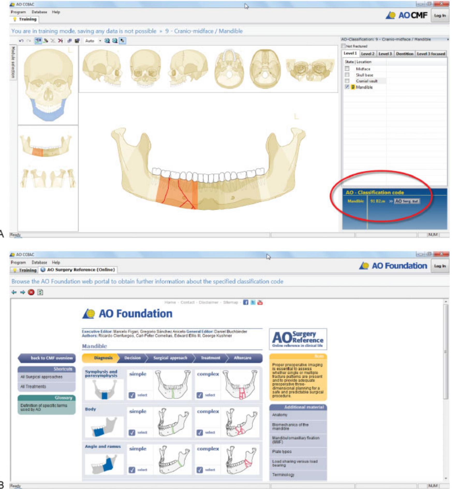 Fracture classification coding and link to surgery