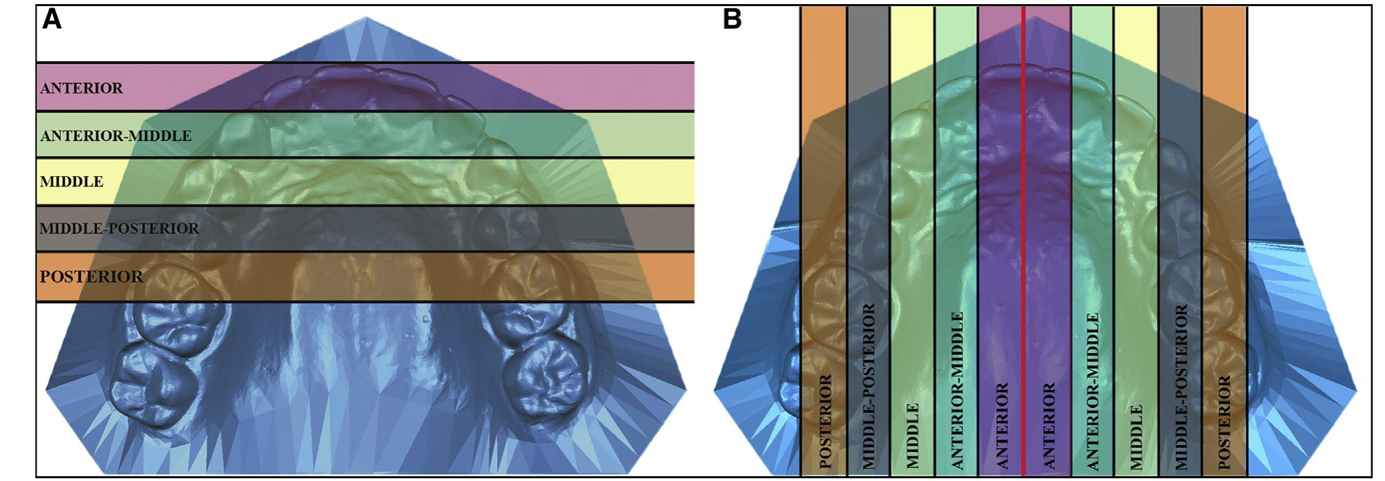 Arch form divisions: a, transverse dimension; b, sagittal