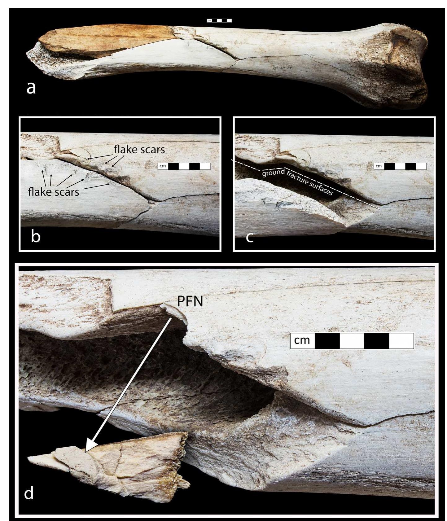 A traumatically fractured femur of an adult female african