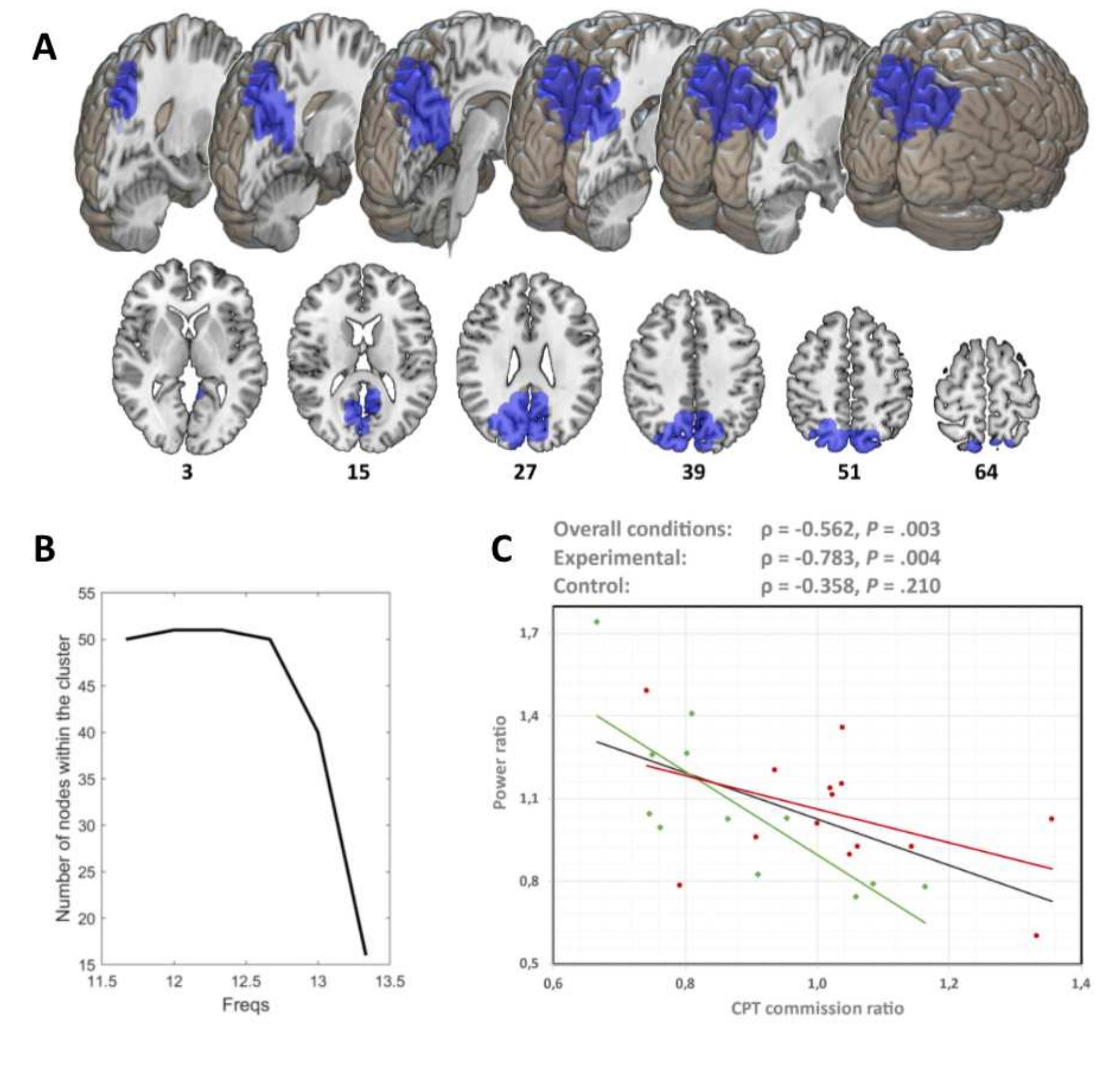 Brain region whose magnetoencephalography alpha power