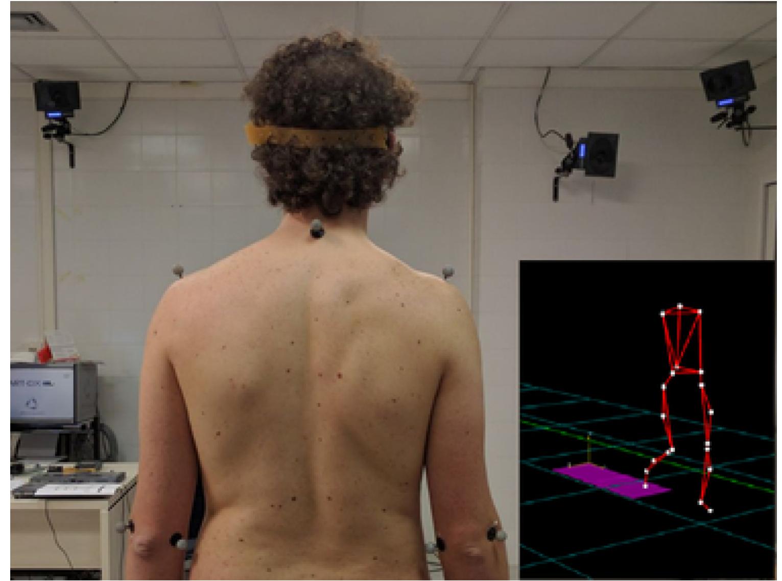 A 3d acquisition system for gait analysis. the 3d skeleton