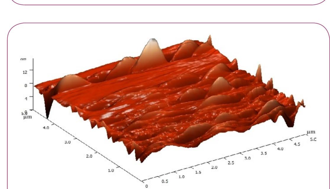 ‘igure 1 sem images of carbopol-cl-poly(hema) polymer film