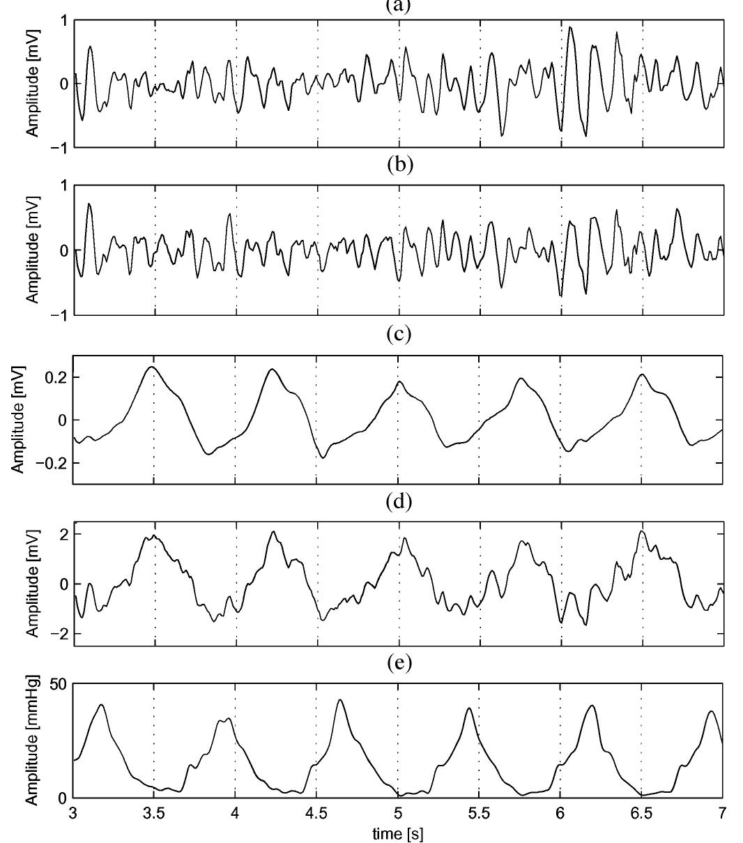 Illustration of signals in the test environment. (a) example