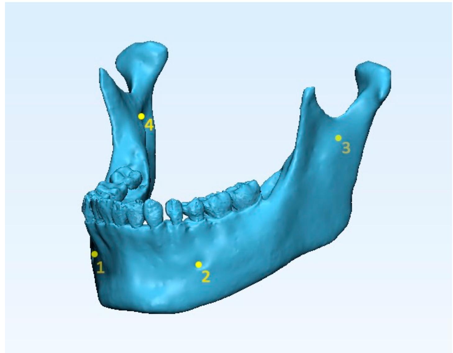 Landmarking four points on 3d mandibular model