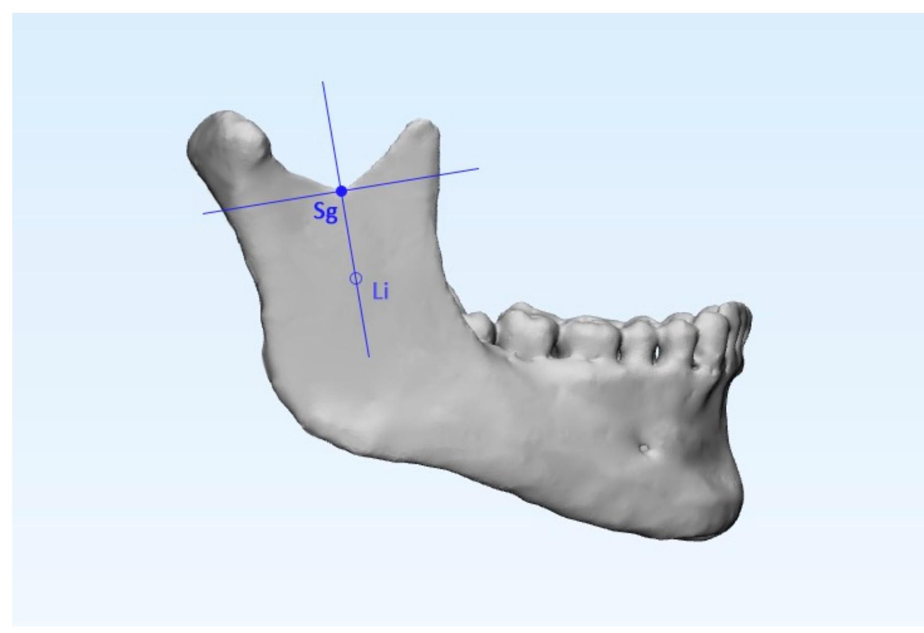 The sigmoid point (sg) and the point representing the