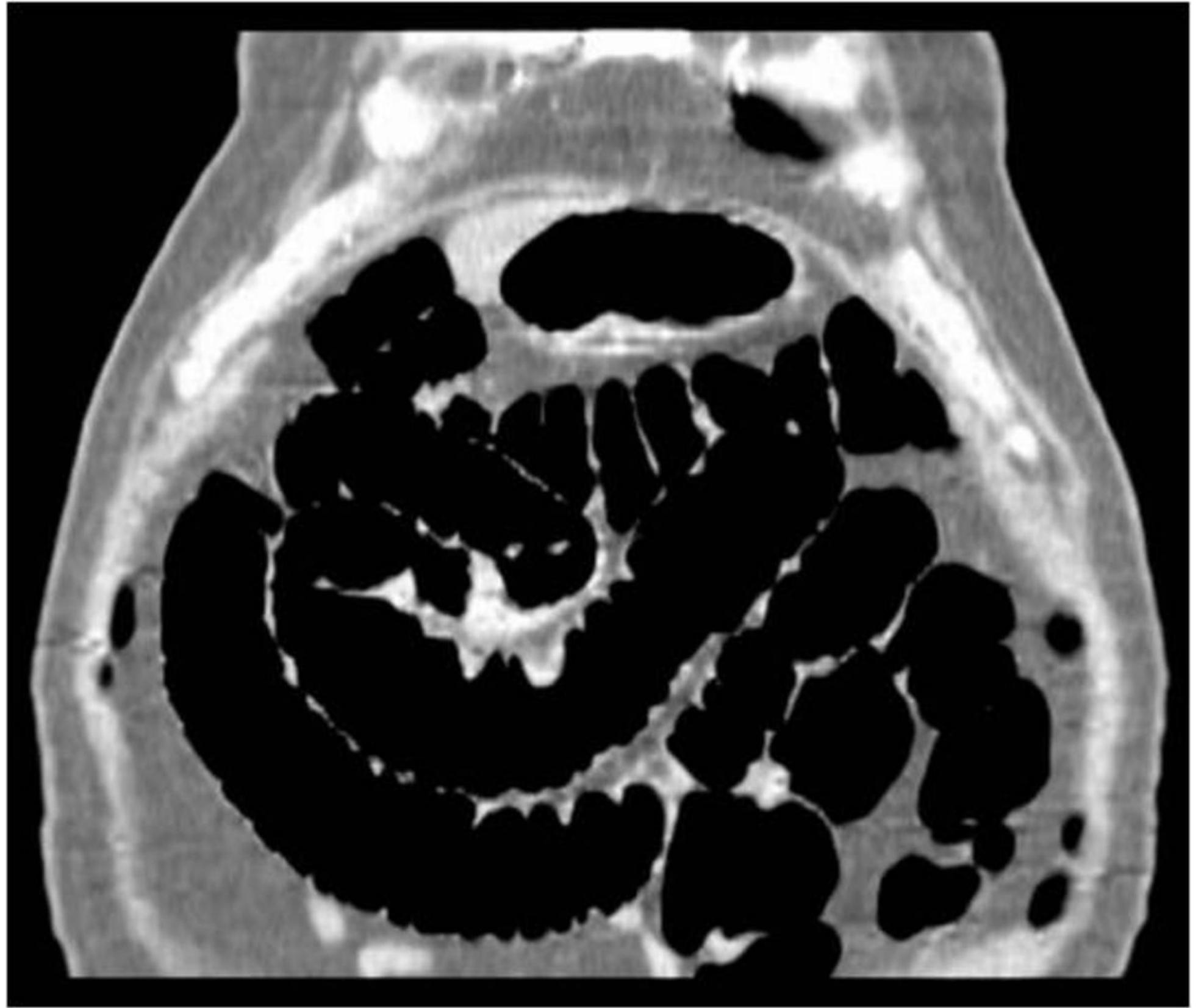 Figure 8 - Eponyms in radiologic signs