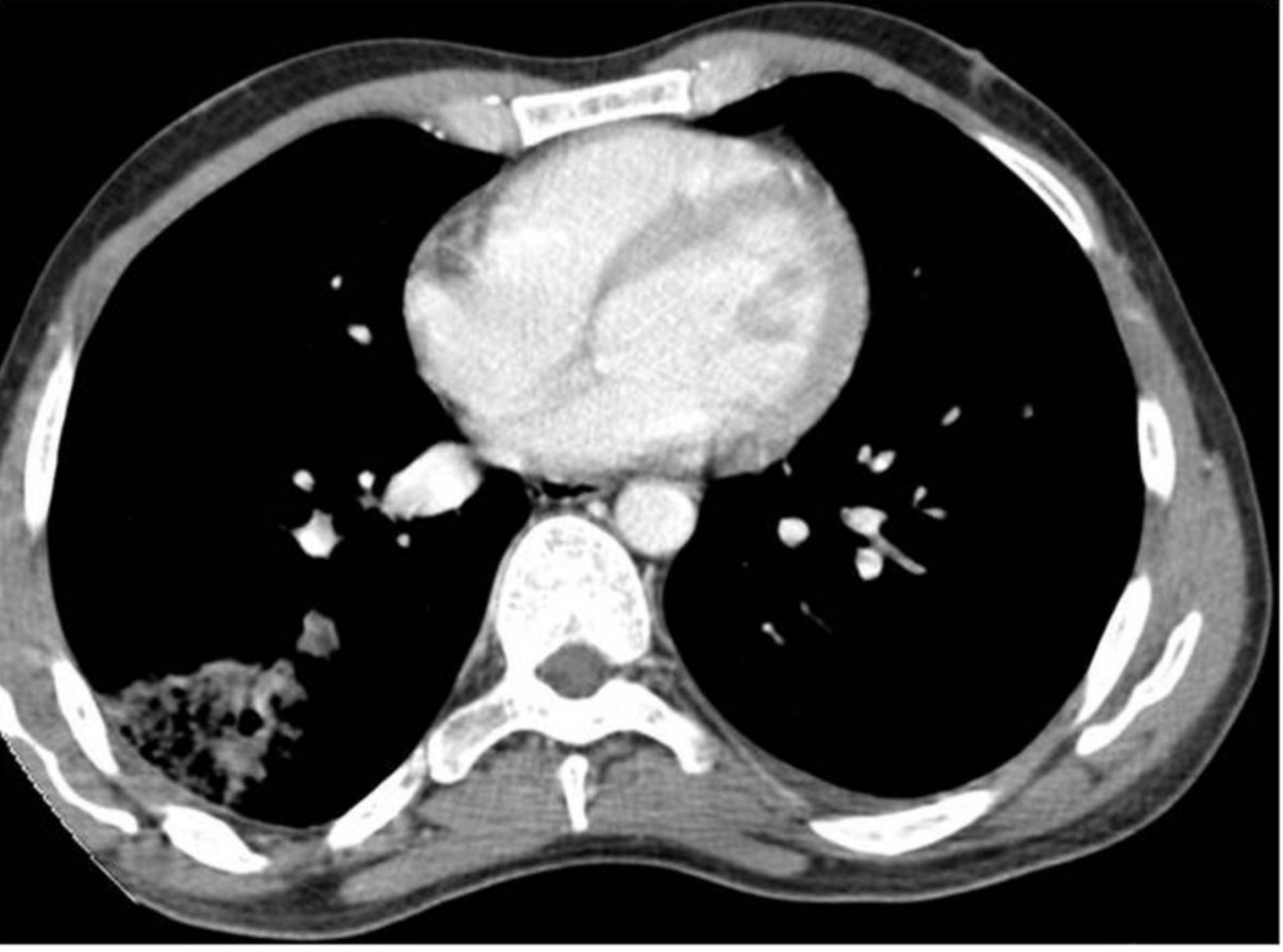 Figure 13 - Eponyms in radiologic signs