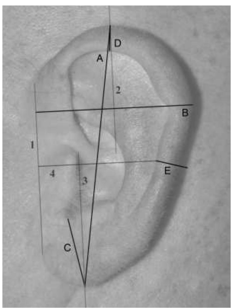 —overview of auricle dimensions and auxiliary lines. a,