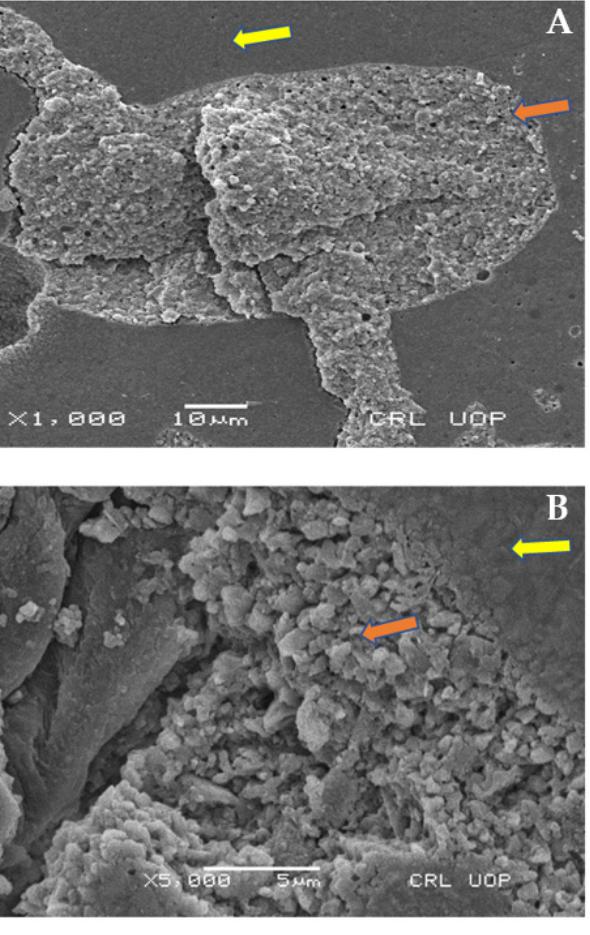 Scanning electron microscopy images showing failure modes of
