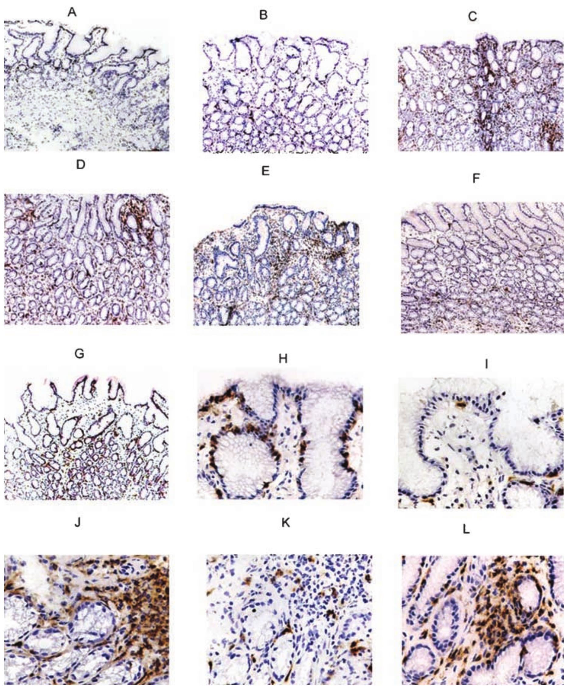 Immunohistochemical localization of mucosal lymphocytes in