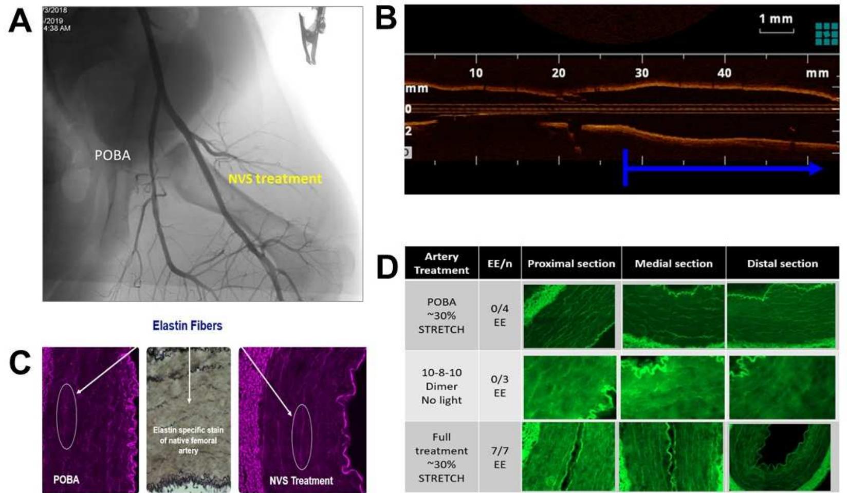 Femoral and iliac arteries of healthy swine were treated
